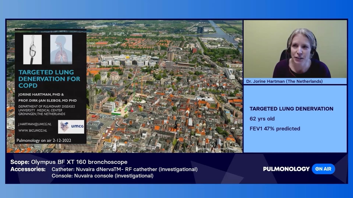 Targeted Lung Denervation - Pulmonology On Air